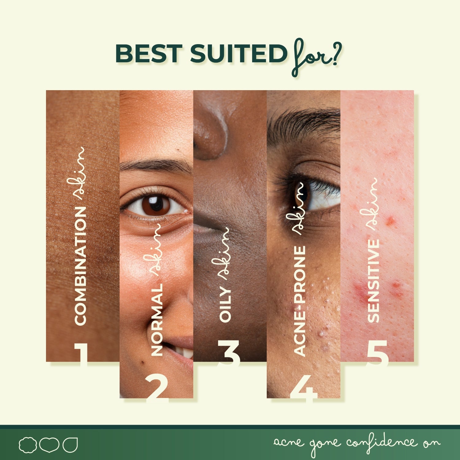 Alite Anti Acne Gel 30 gm | Fast Action on Acne, Pimples | Treats, Rep ...