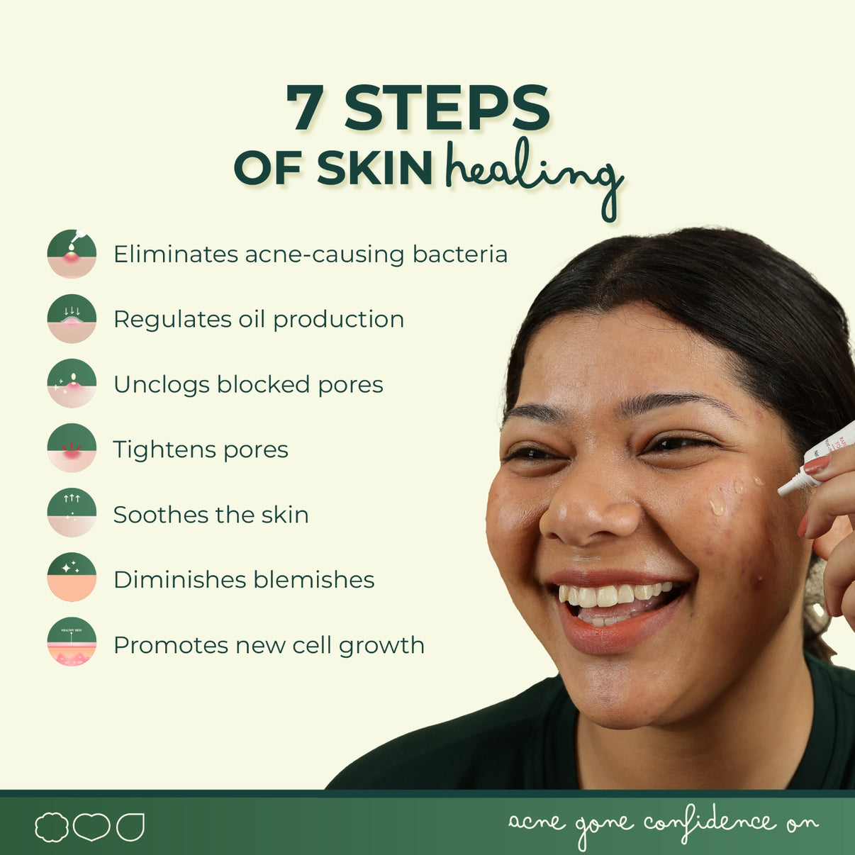 Alite Anti Acne Gel 30 gm | Fast Action on Acne, Pimples | Treats, Rep ...